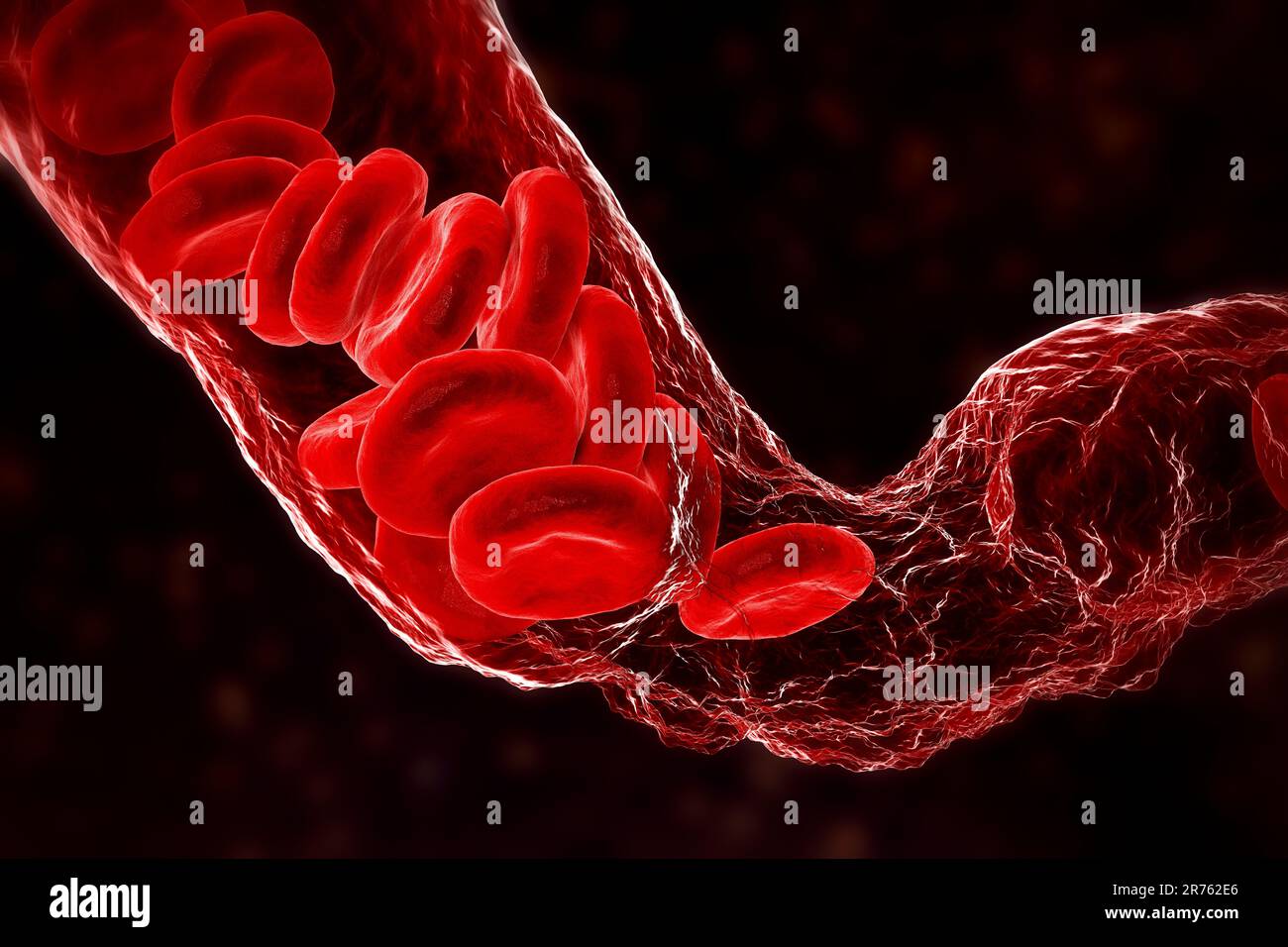 Blood clot, computer artwork Stock Photo - Alamy