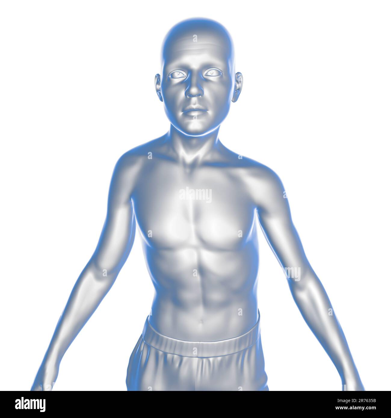 Scoliosis in children, computer illustration. A child with curved spine ...