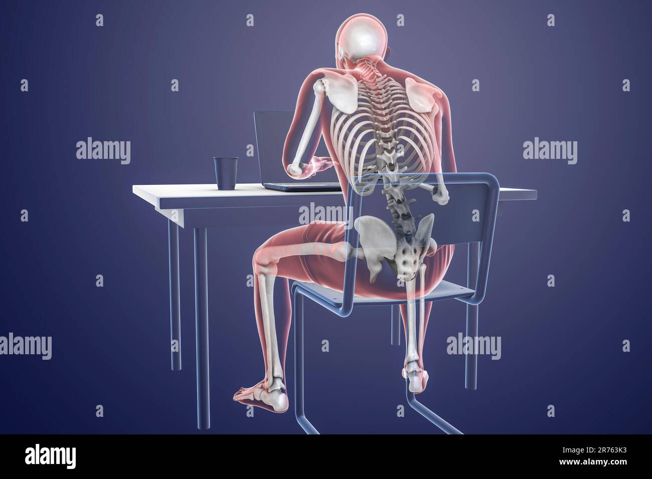 Working with laptop in a wrong position. Concept of back pain. Computer ...