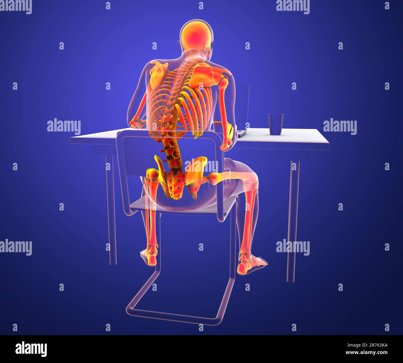 Working with laptop in a wrong position. Concept of back pain. Computer ... Working with laptop in a wrong position. Concept of back pain. Computer ...
