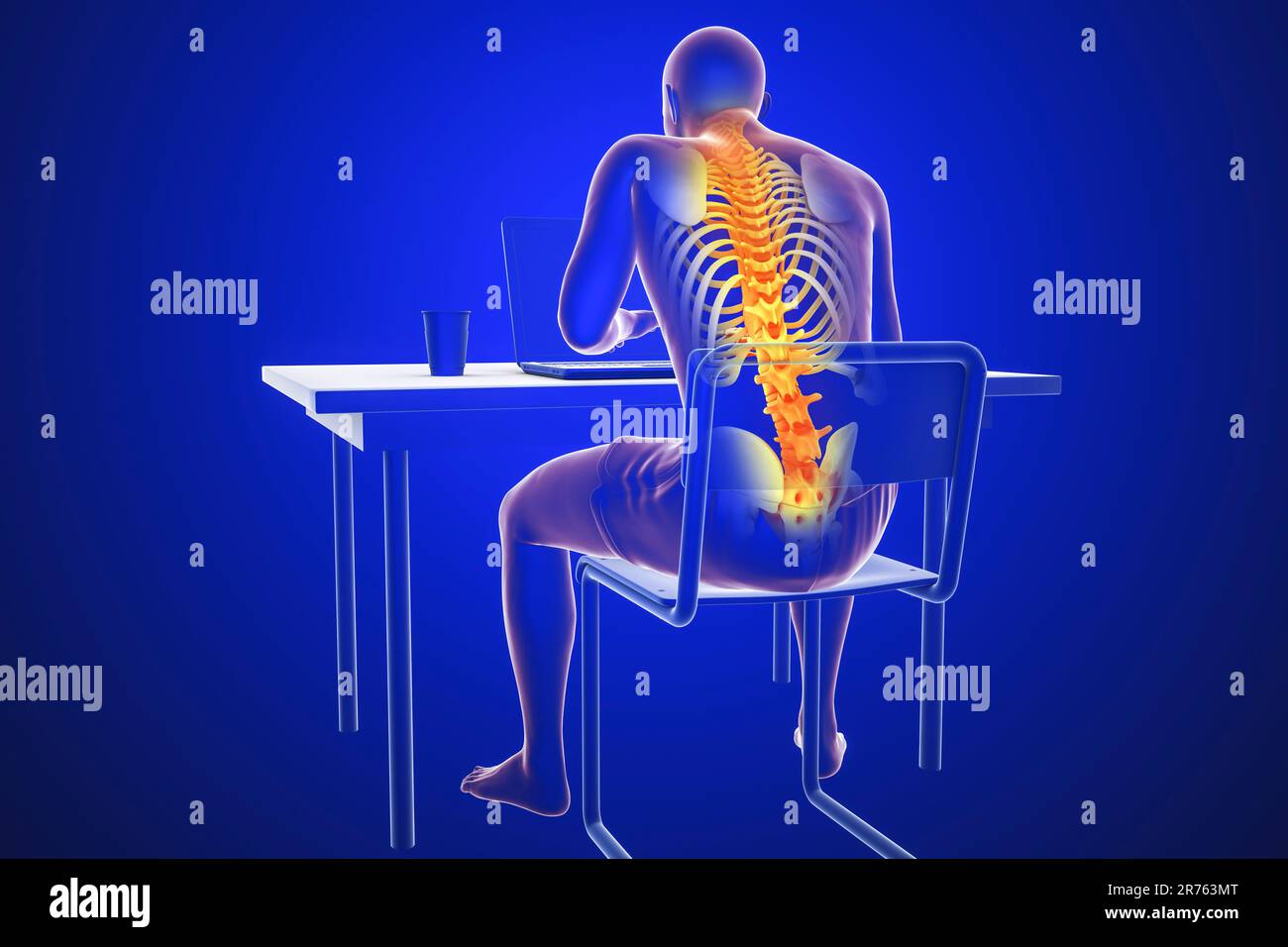 Working with laptop in a wrong position. Concept of back pain. Computer ...