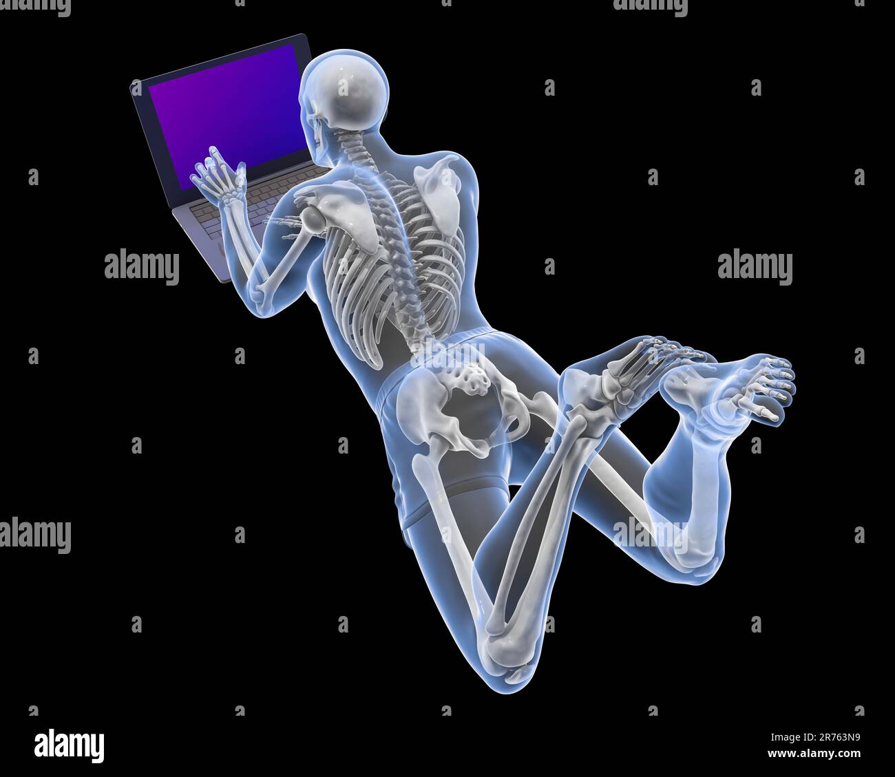 Working with laptop in a wrong position. Concept of back pain. Computer ...