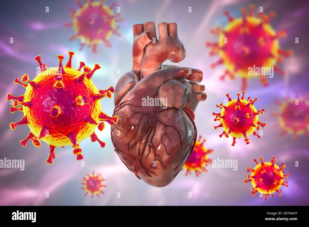COVID-19 viruses affecting the heart, conceptual 3D illustration ...