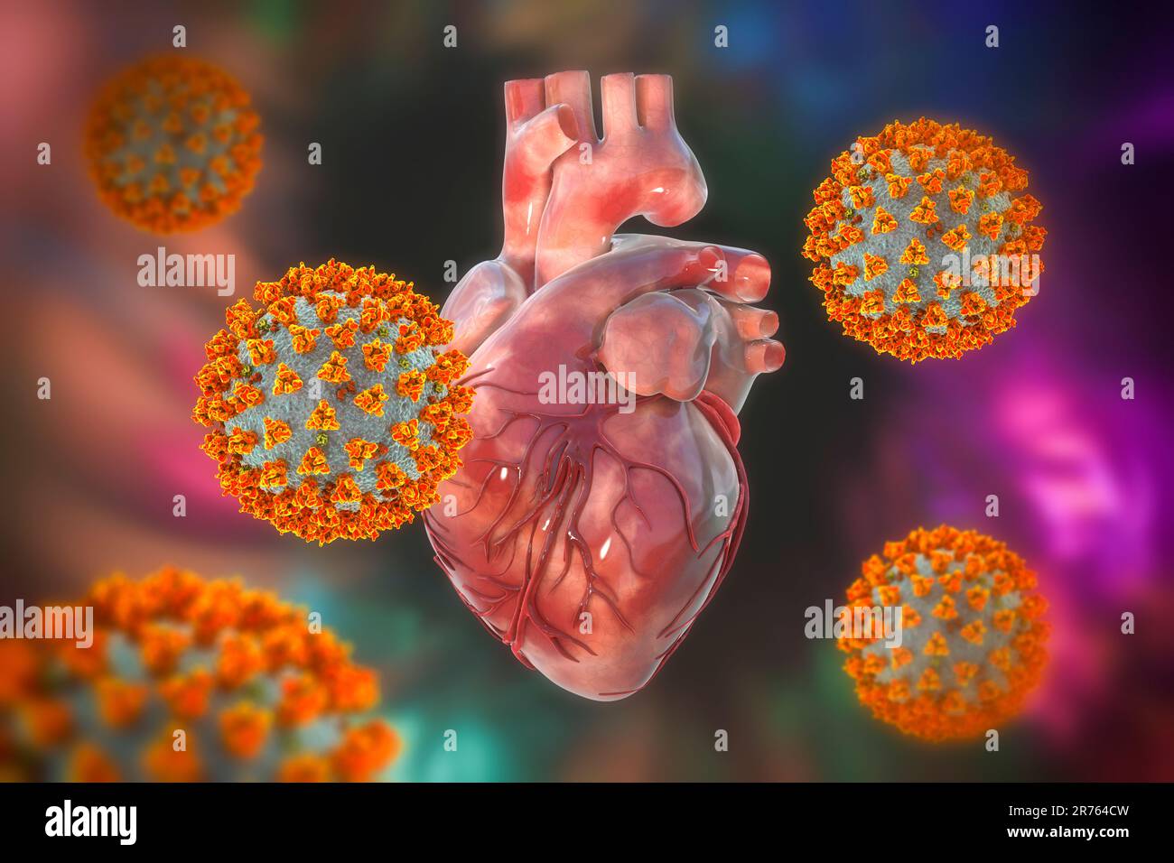 COVID-19 viruses affecting the heart, conceptual 3D illustration ...