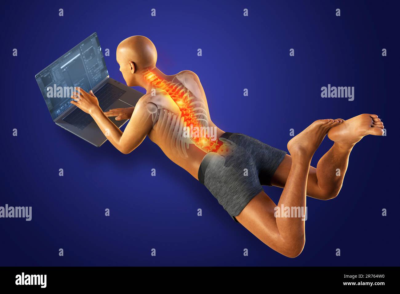 Working with laptop in a wrong position. Concept of back pain. Computer ...