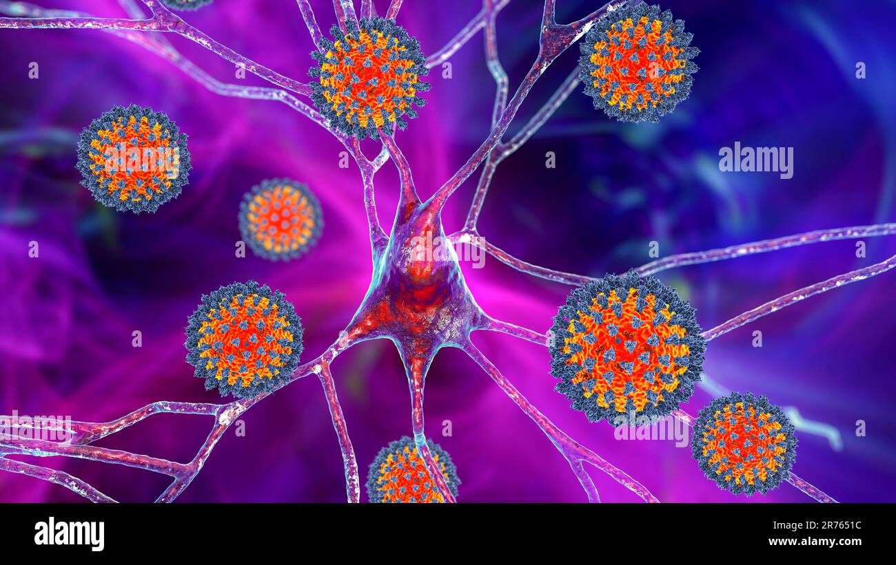 Illustration of SARS-Cov-2 viruses, the cause of Covid-19, infecting ...