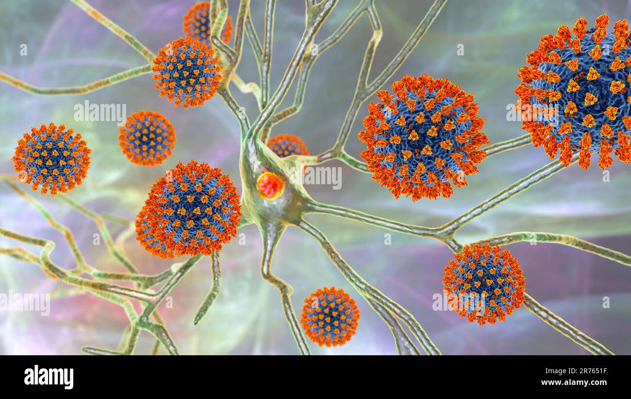 Illustration of SARS-Cov-2 viruses, the cause of Covid-19, infecting ...