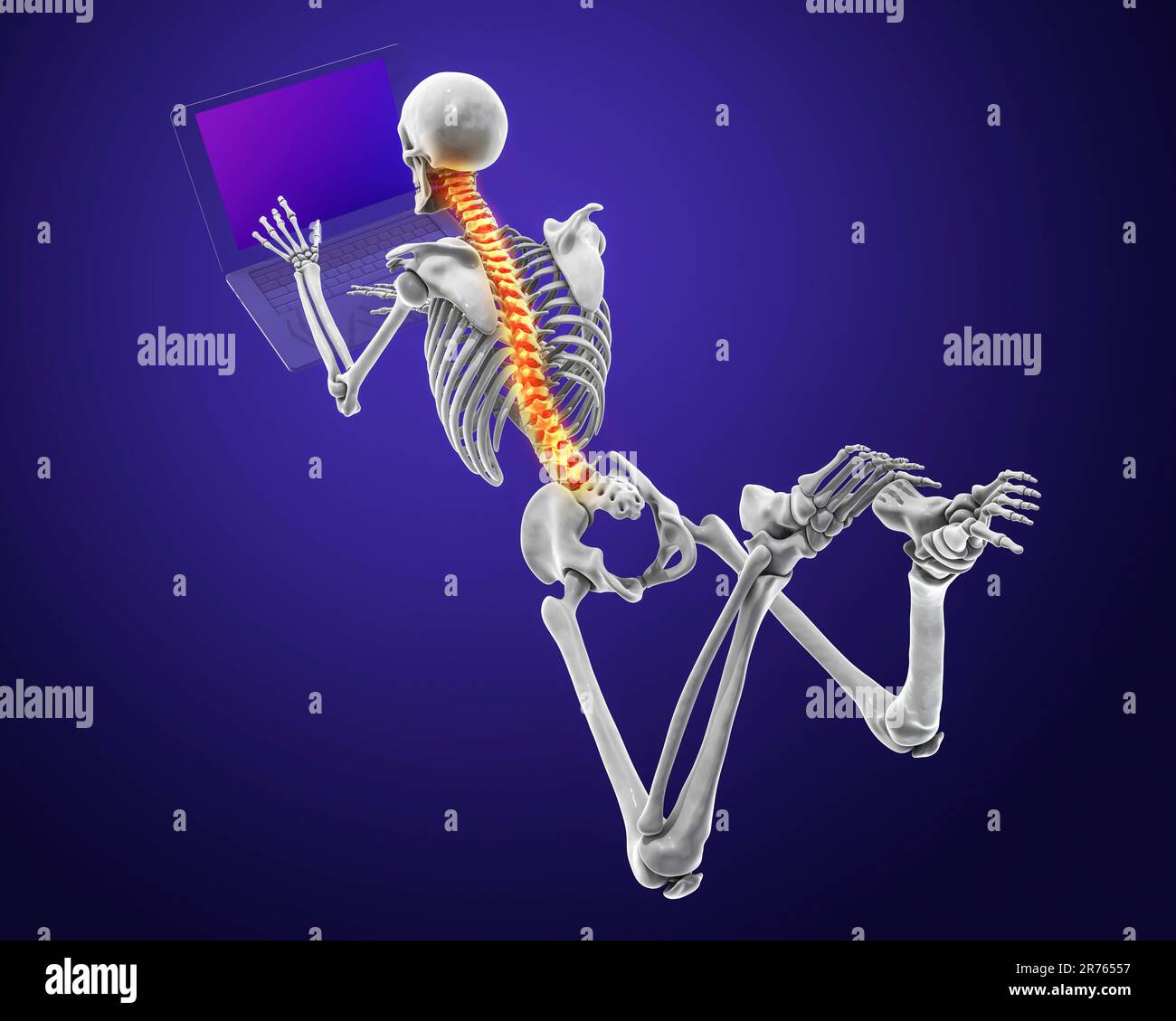 Working with laptop in a wrong position. Concept of back pain. Computer ... Working with laptop in a wrong position. Concept of back pain. Computer ...