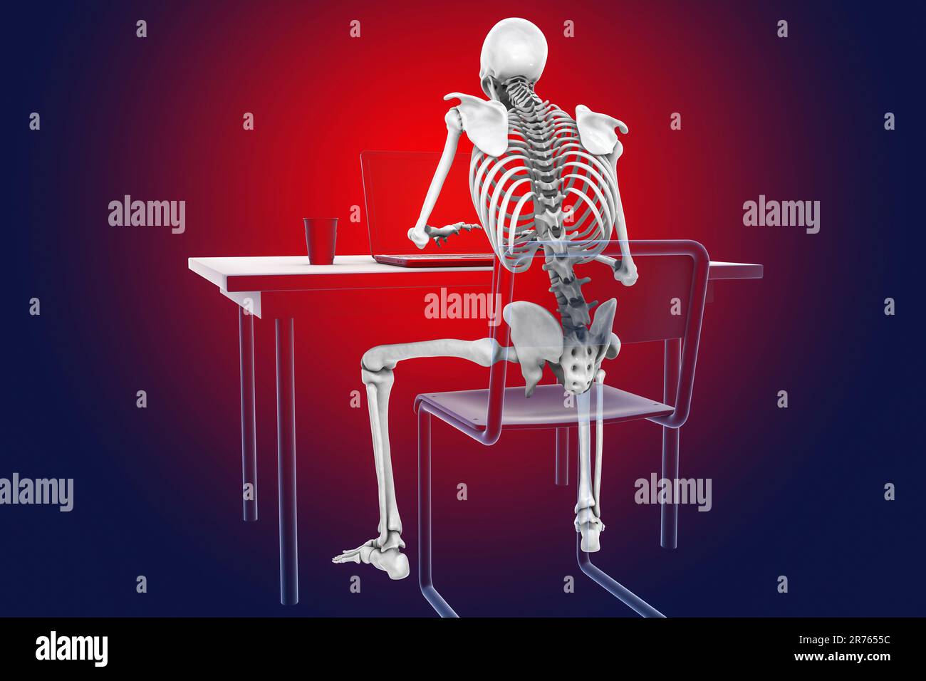 Working with laptop in a wrong position. Concept of backache, back pain ... Working with laptop in a wrong position. Concept of backache, back pain ...
