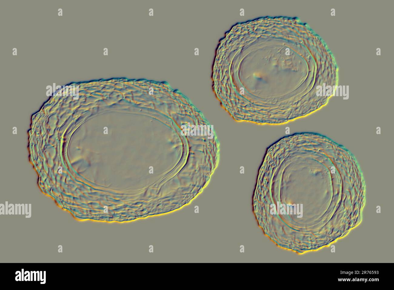 Ascaris Lumbricoides Egg Ascaris Lumbricoides Worm Encountered In The