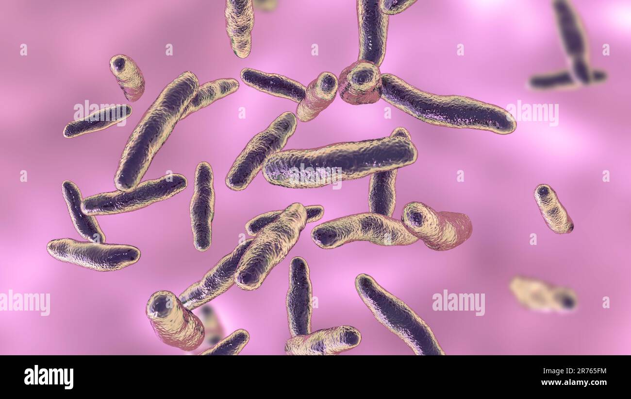 Lower intestinal tract hi-res stock photography and images - Alamy