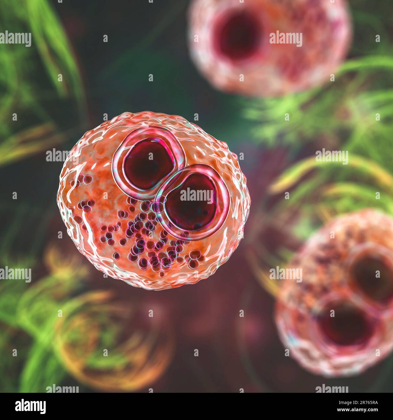 Cytomegalovirus infection. Computer illustration of human cells showing ...