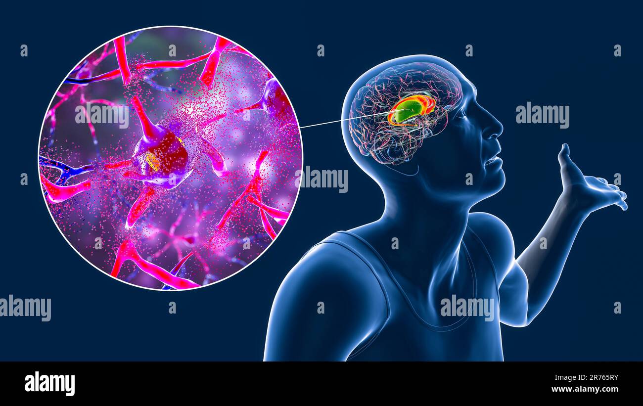 Dorsal striatum, caudate nucleus and putamen, highlighted in the brain ...
