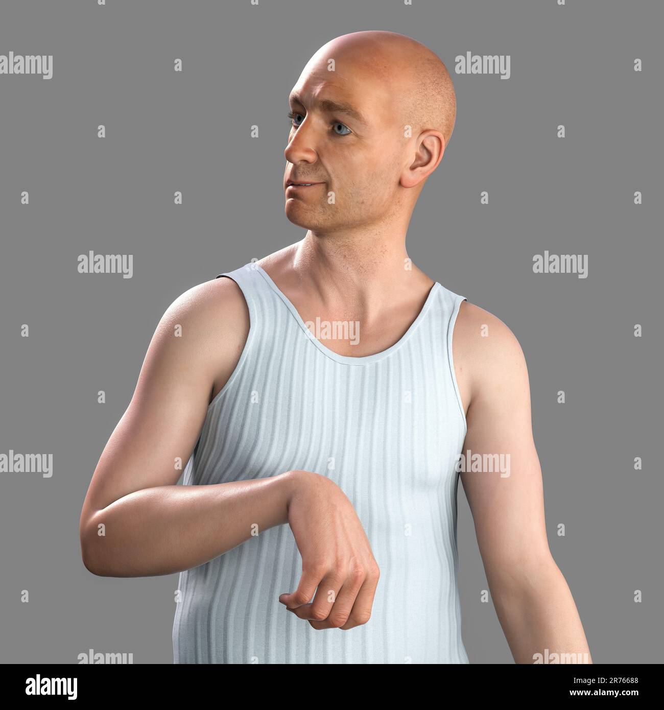 Huntington's disease brain hi-res stock photography and images - Alamy