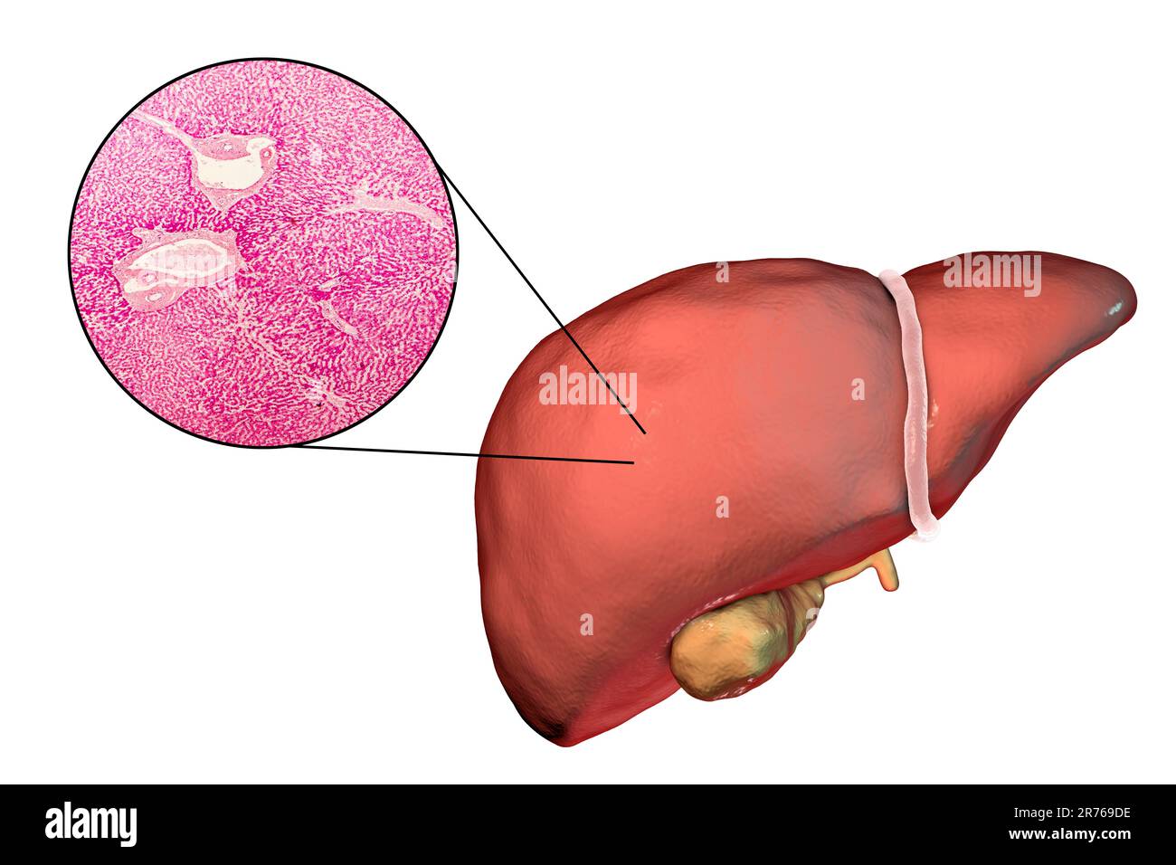 Healthy liver, computer illustration and micrograph of a section ...