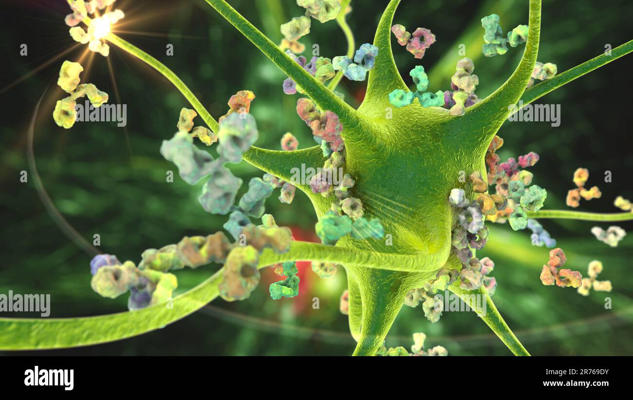 Antibodies attacking neurons, conceptual computer illustration of ...