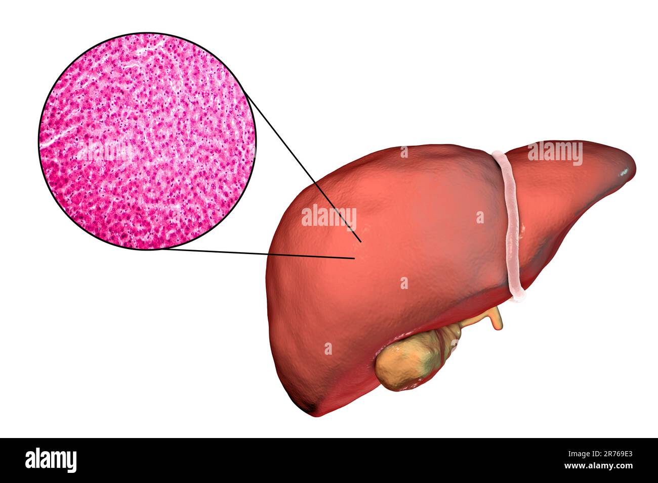 Healthy liver, computer illustration and micrograph of a section ...