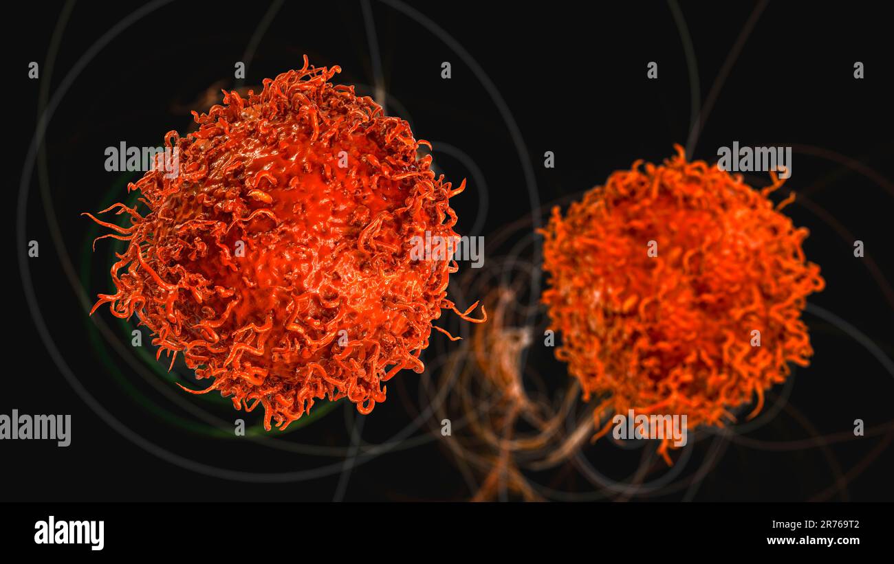 Stomach cancer cells, computer artwork Stock Photo - Alamy