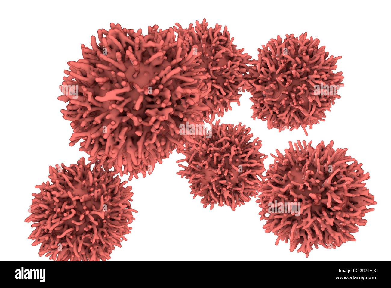 Thyroid cancer cells, computer illustration Stock Photo - Alamy