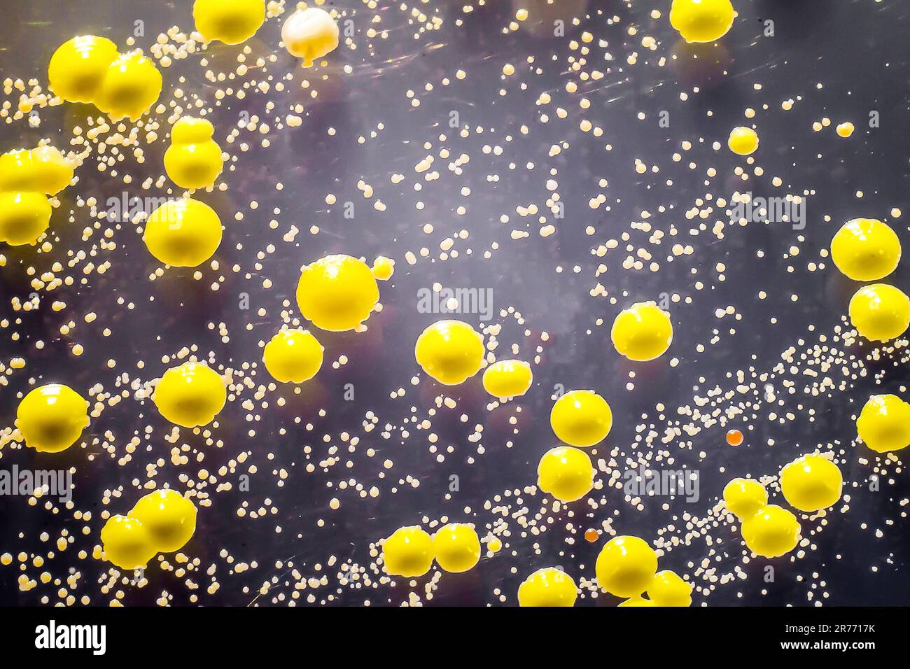 Bacteria grown from a skin smear, colonies of Micrococcus luteus and ...