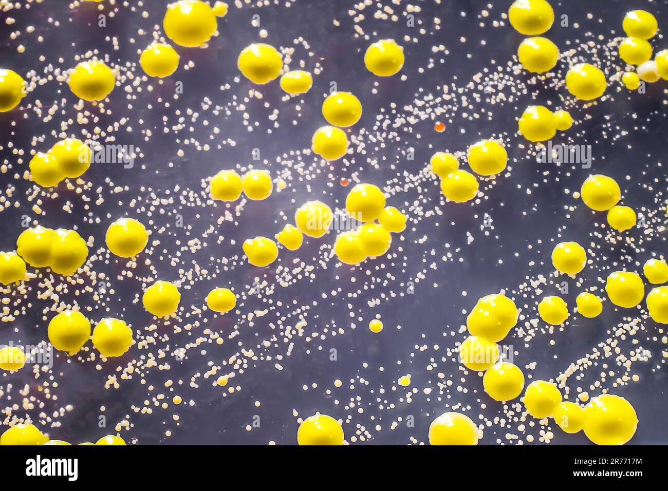 Bacteria grown from a skin smear, colonies of Micrococcus luteus and ...