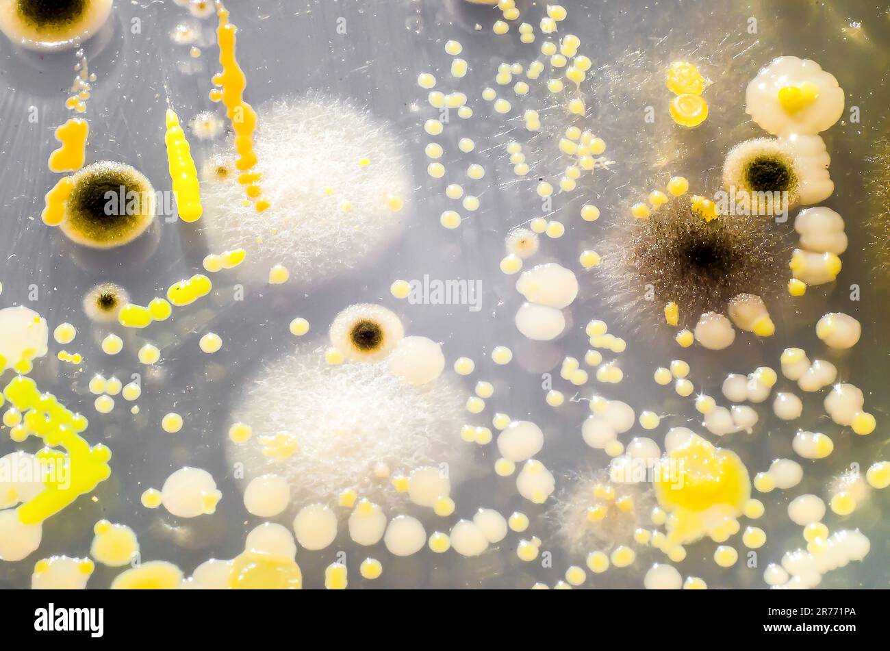 Colonies different bacteria mold hi-res stock photography and images ...