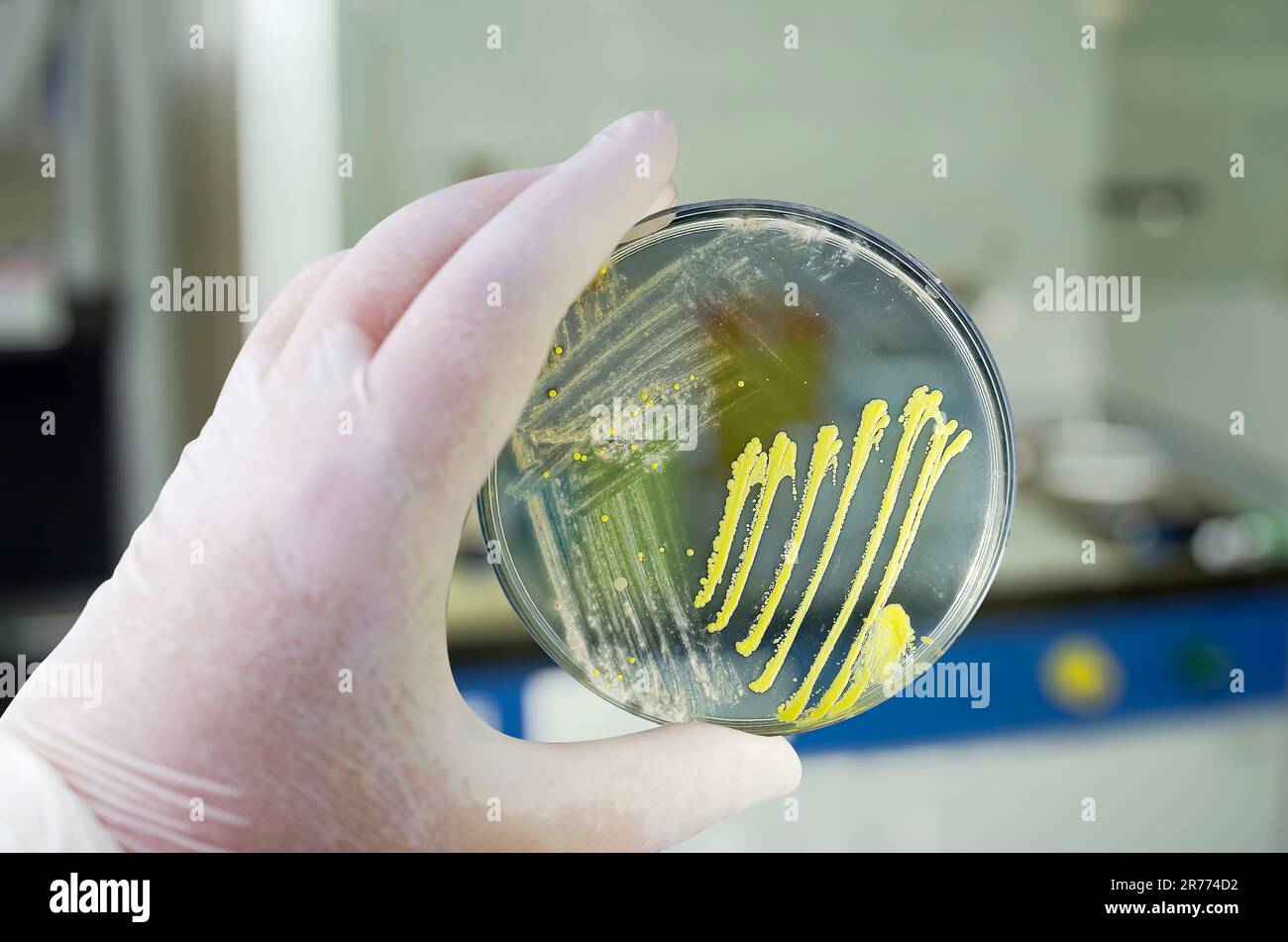 Colonies of different bacteria and mold fungi grown on Petri dish with ...