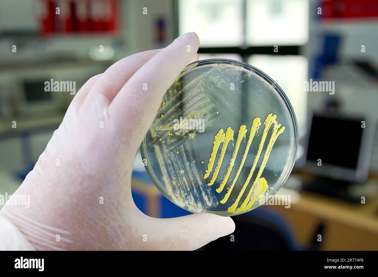Different agar bacteria colonies hi-res stock photography and images ...