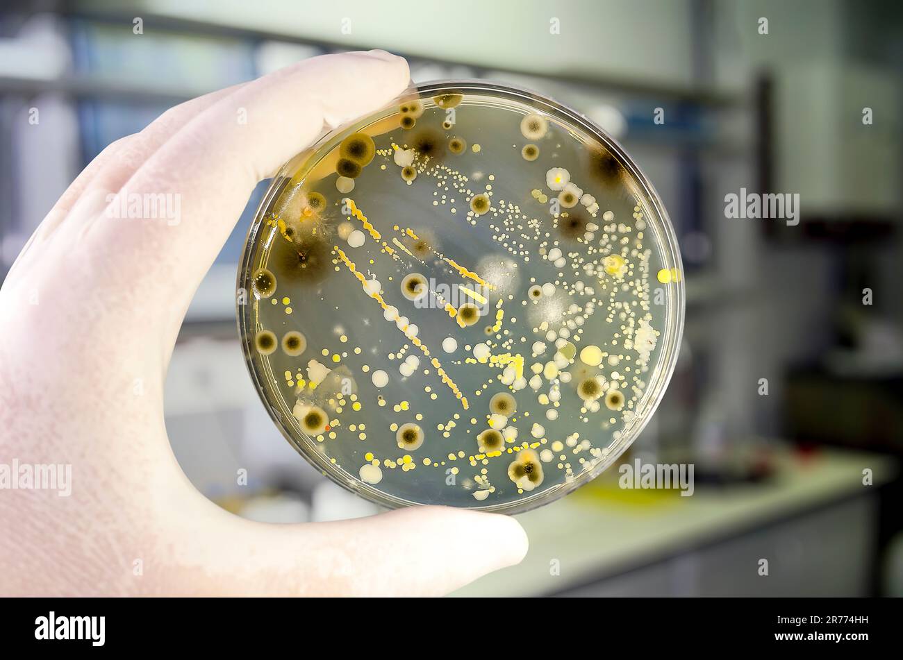 Colonies of different bacteria and mold fungi grown on Petri dish with ...