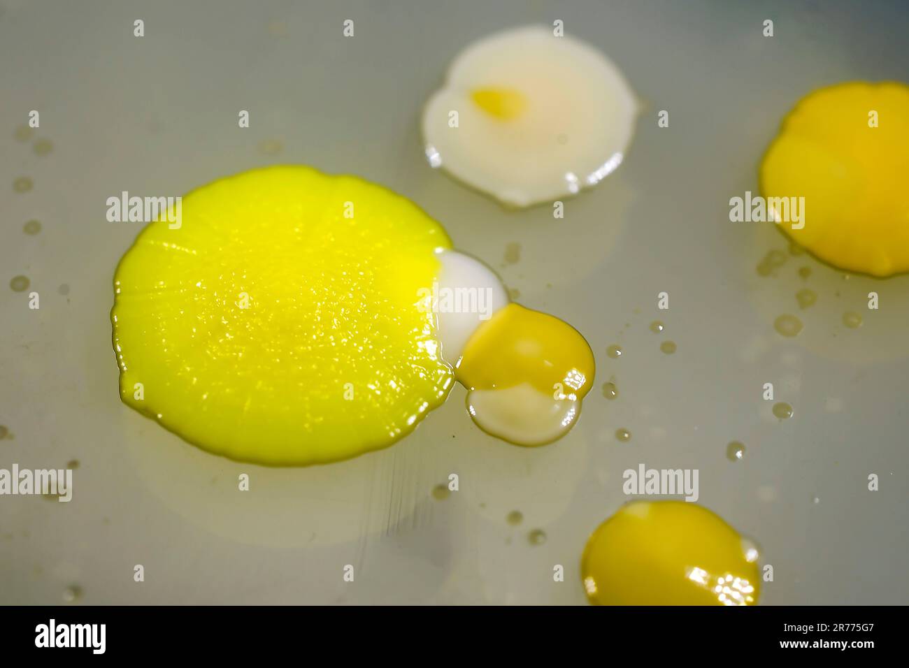 Colonies of different bacteria from human skin grown on Petri dish with ...