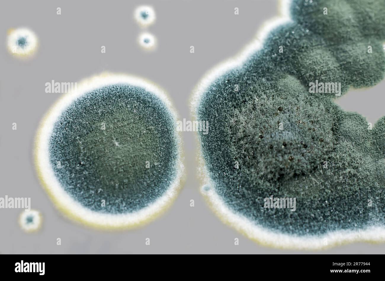 Colonies of Penicillium fungi grown on Sabouraud Dextrose Agar (SDA ...