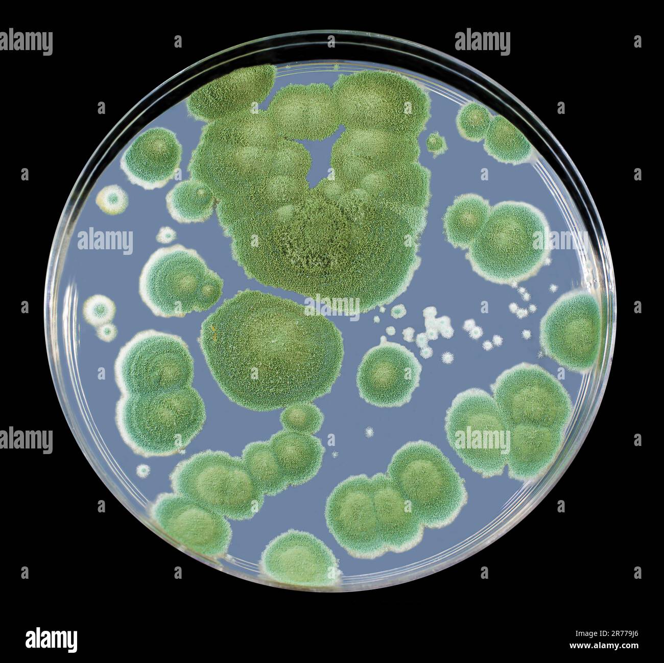 Colonies of Penicillium fungi grown on Sabouraud Dextrose Agar (SDA ...