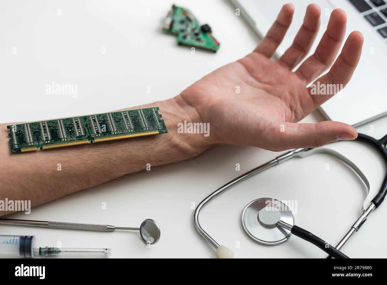 Hand with implantation of micro chip. X-Ray view close-up. Chipization ...