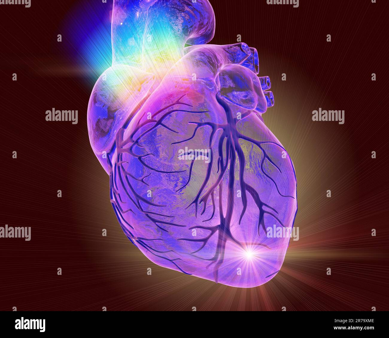 Heart attack, conceptual image for heart diseases. 3D illustration ...