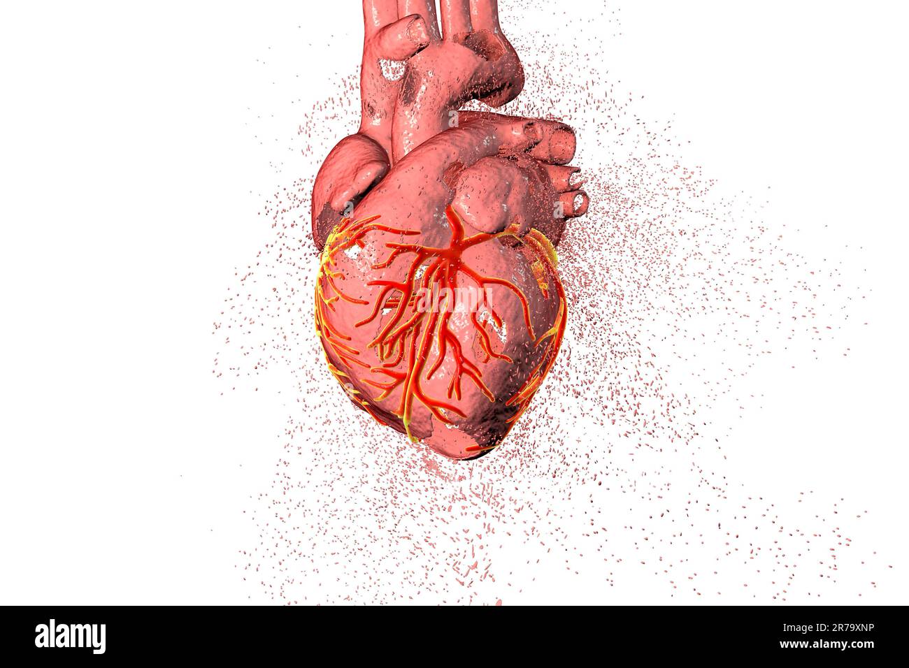 Destruction of heart. Heart disease concept, 3D illustration Stock ...