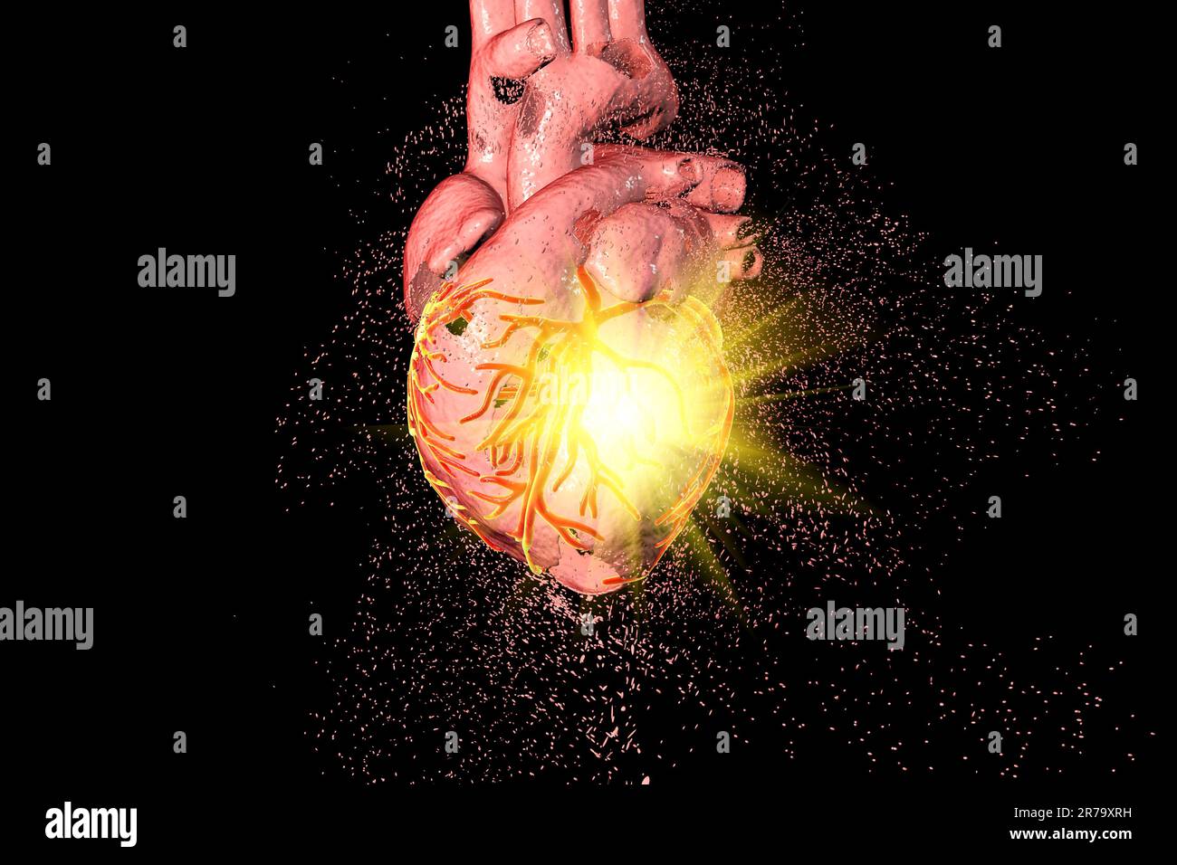 Destruction of heart. Heart disease concept, 3D illustration Stock ...