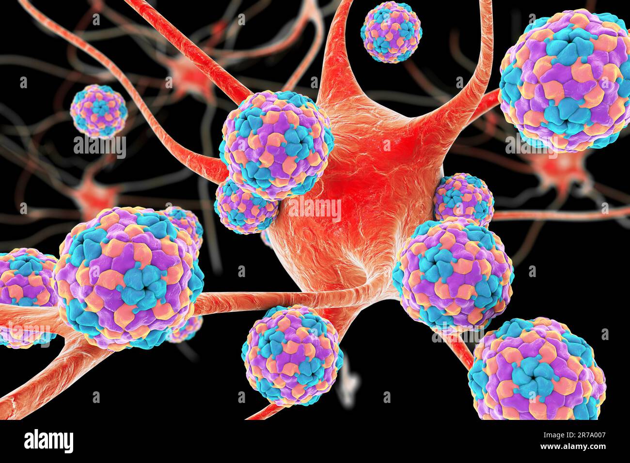 Human Parechoviruses affecting neuron, 3D illustration. Parechoviruses ...
