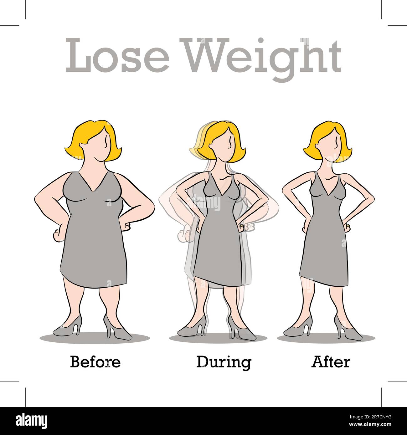 Before and after weight loss girl hi-res stock photography and images ...