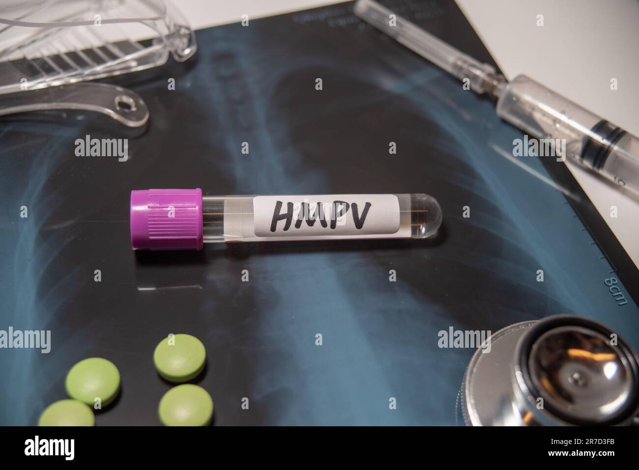 Background of Human Metapneumovirus (HMPV) RT-PCR Kit ,Medical health ...