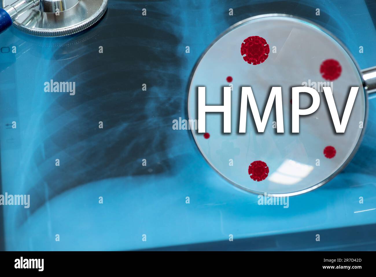 Background of Human Metapneumovirus (HMPV) RT-PCR Kit ,Medical health ...