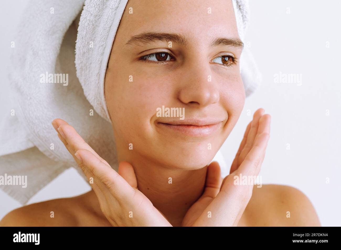 Portrait young teenage girl with problem skin Stock Photo - Alamy