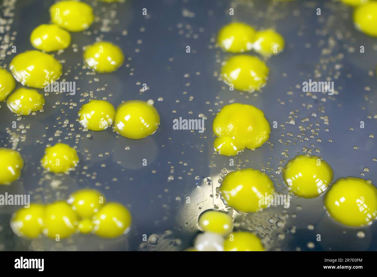 Bacteria grown from skin smear, colonies of Micrococcus luteus and ...