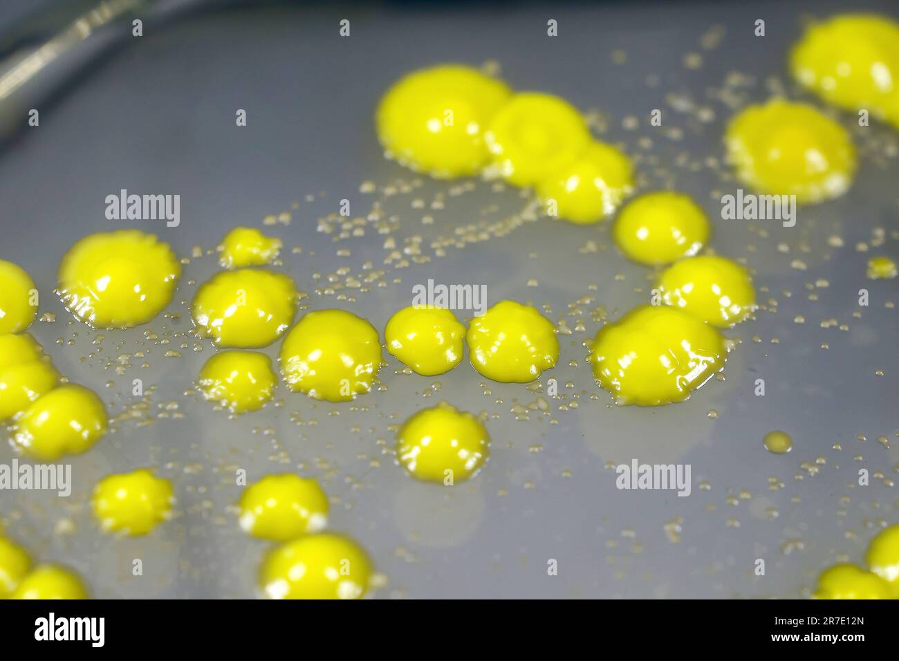 Bacteria grown from skin smear, colonies of Micrococcus luteus and ...