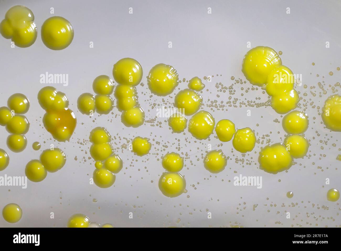 Bacteria grown from skin smear, colonies of Micrococcus luteus and ...
