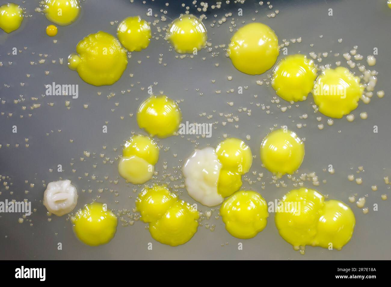 Bacteria grown from skin smear, colonies of Micrococcus luteus and ...