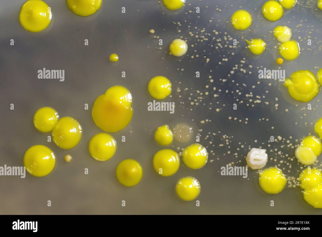 Bacteria grown from skin smear, colonies of Micrococcus luteus and ...