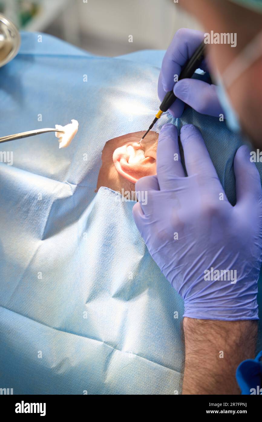 Plastic surgeon performs surgery on patient ear using ultrasonic knife ...