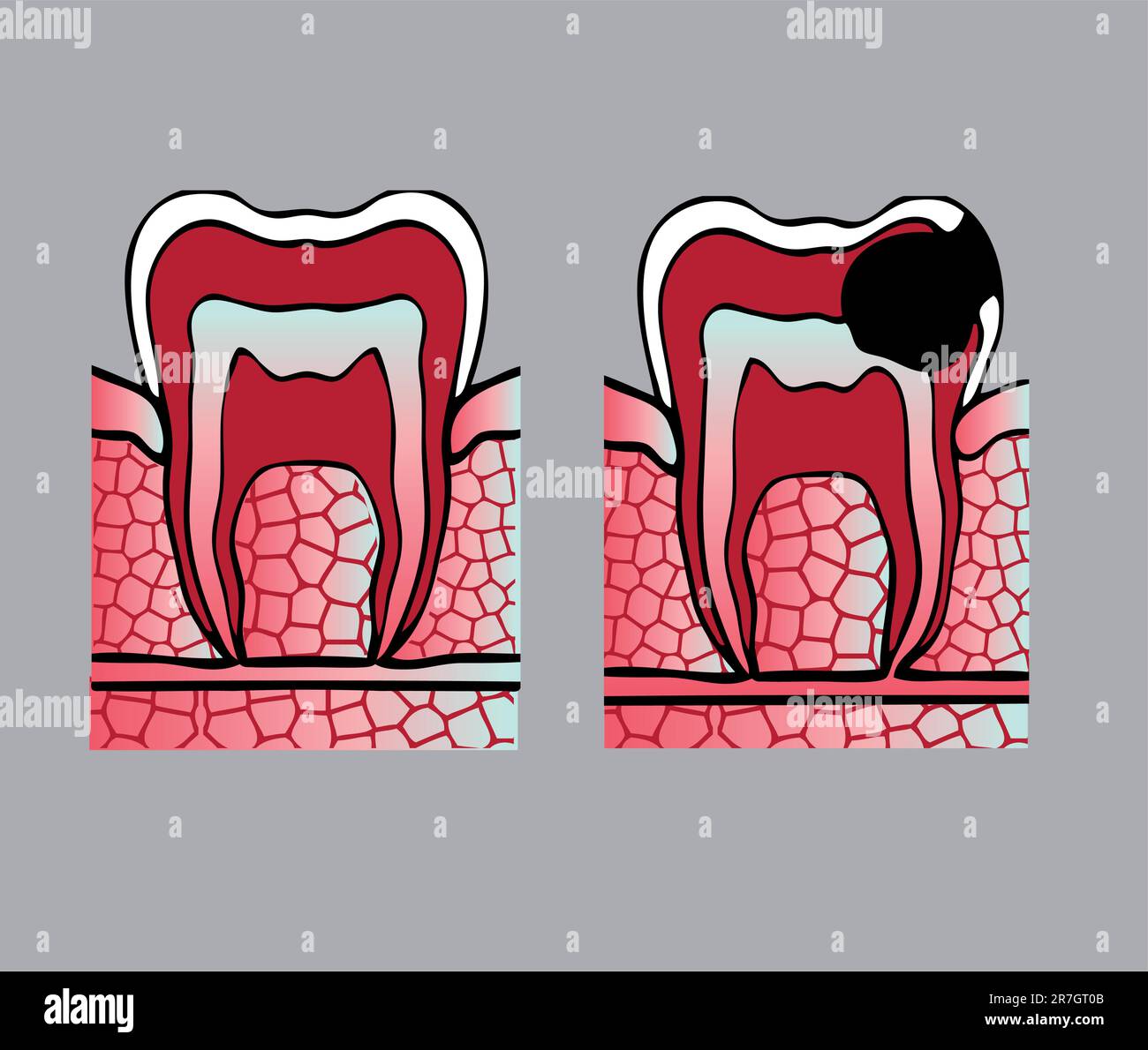Bright tooth Stock Vector Images - Alamy
