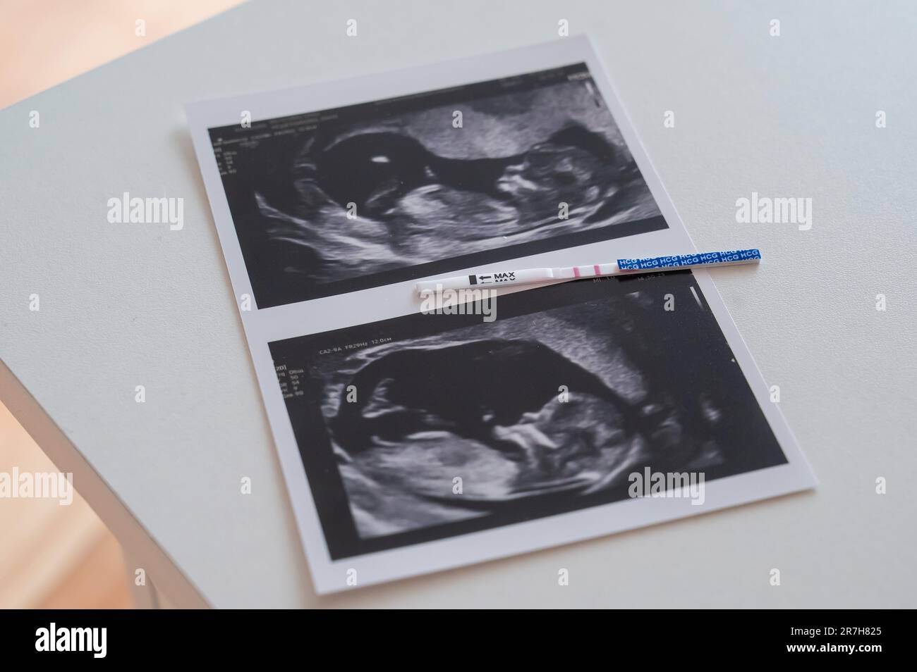 Positive pregnancy test in a photo from an ultrasound on a white table ...
