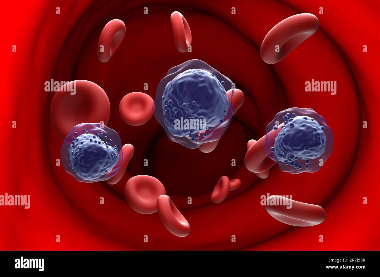 Acute myeloid leukemia (AML) cells in blood flow - section view 3d ...
